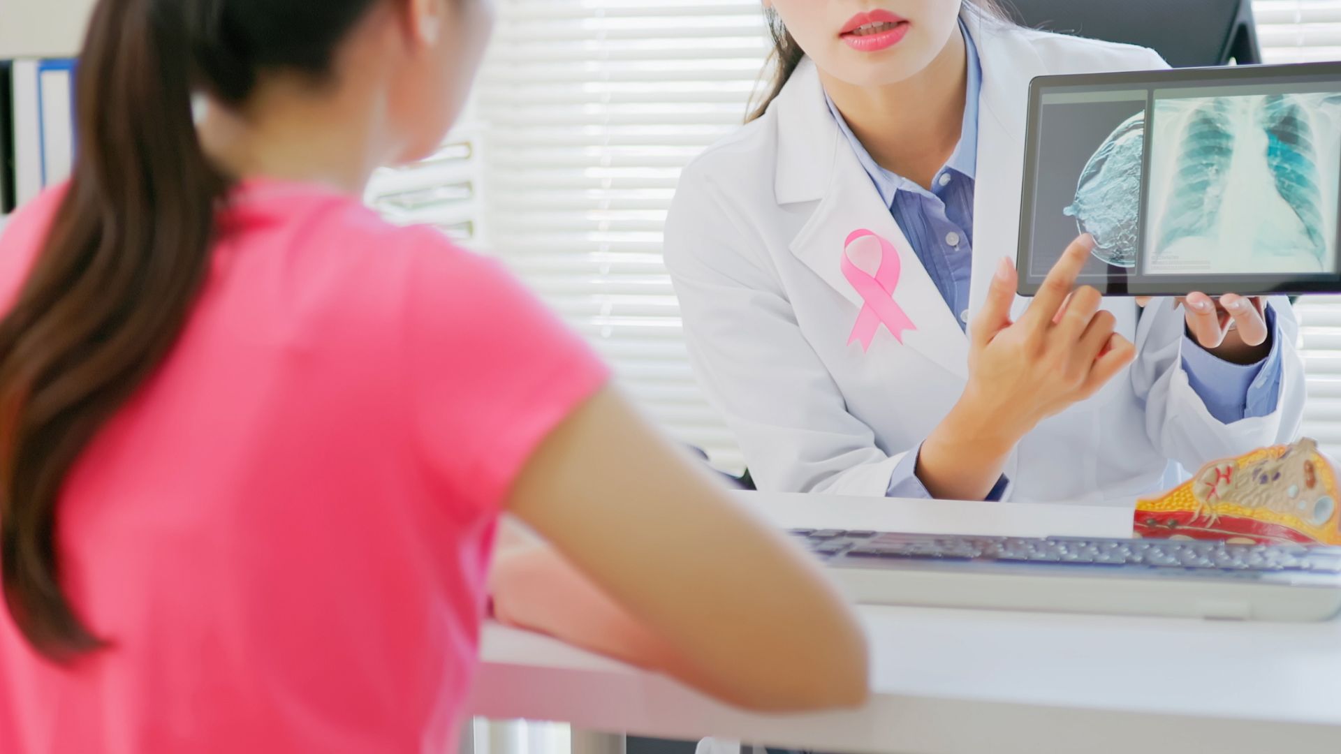 Breast Cancer Statistics 2024: Key Facts and Trends